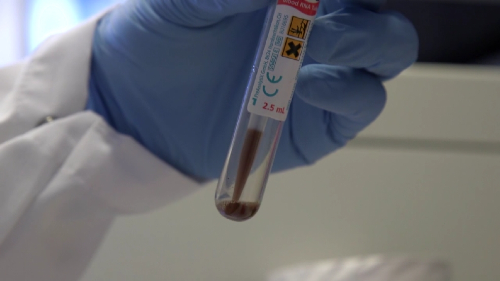 New blood test can detect bacteria vs viral infections | WKRC